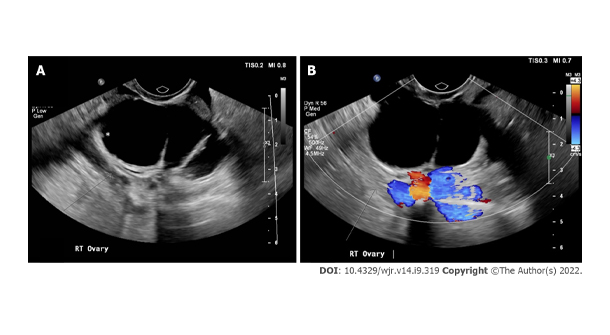 World Journal of Radiology - Baishideng Publishing Group