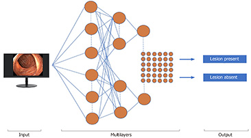 Artificial Intelligence in Gastrointestinal Endoscopy - Baishideng ...