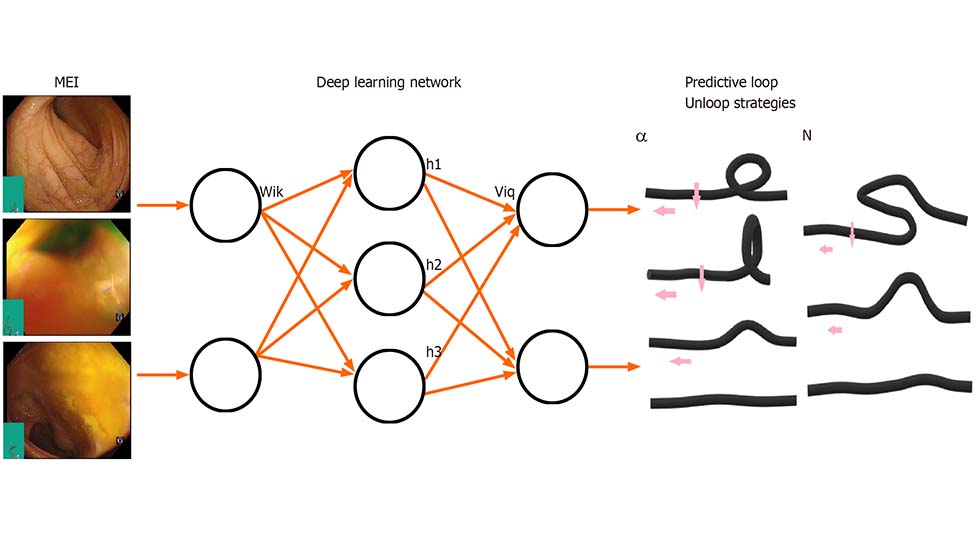 Artificial Intelligence in Gastrointestinal Endoscopy - Baishideng ...