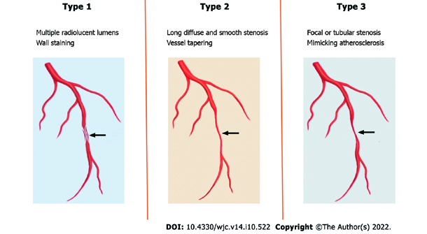World Journal of Cardiology - Baishideng Publishing Group