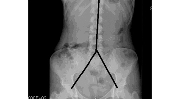 World Journal of Gastrointestinal Pharmacology and Therapeutics ...